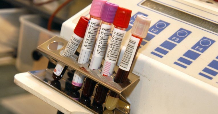 Les salariés de Biopath-Unilabs en grève à partir du 29 septembre 2020 ...